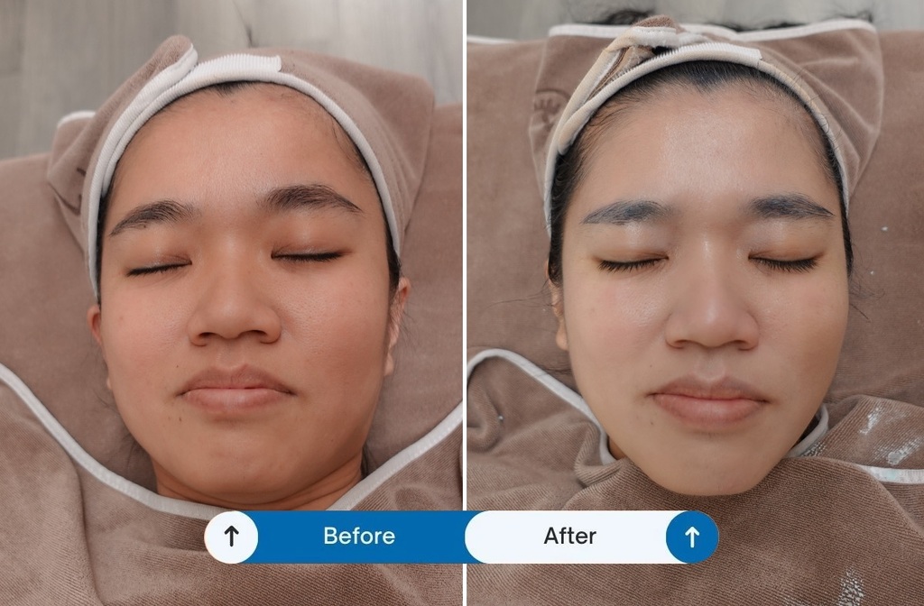 Donna Salon 評價｜肌膚管理 0 痛感無修復期，單堂制中山站做臉推薦